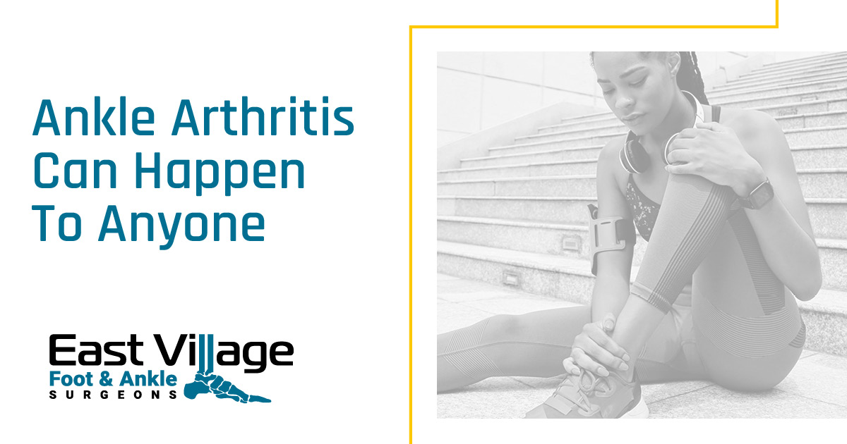 EVFAS Post Traumatic Arthritis EVFAS Post Traumatic Arthritis